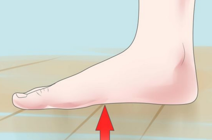 Plantar Fasiit Nedir?